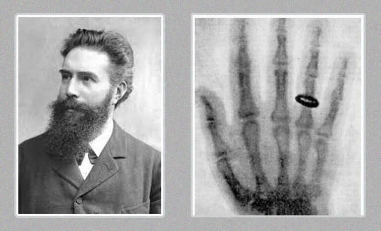 The History of Radiology: 130 Years of Medical Imaging
